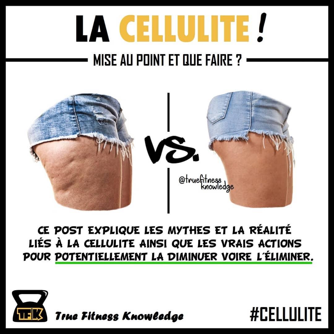 Agir sur la cellulite - True Fitness Knowledge